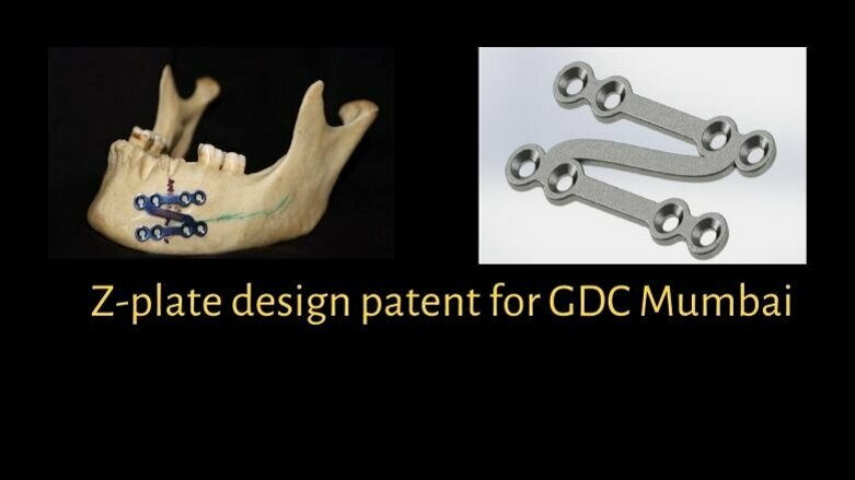 "Z-plate for mandibular fractures"- Design patent for Dr Kende & team ...