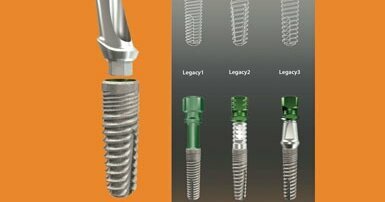 Implant Direct Legacy™ System
