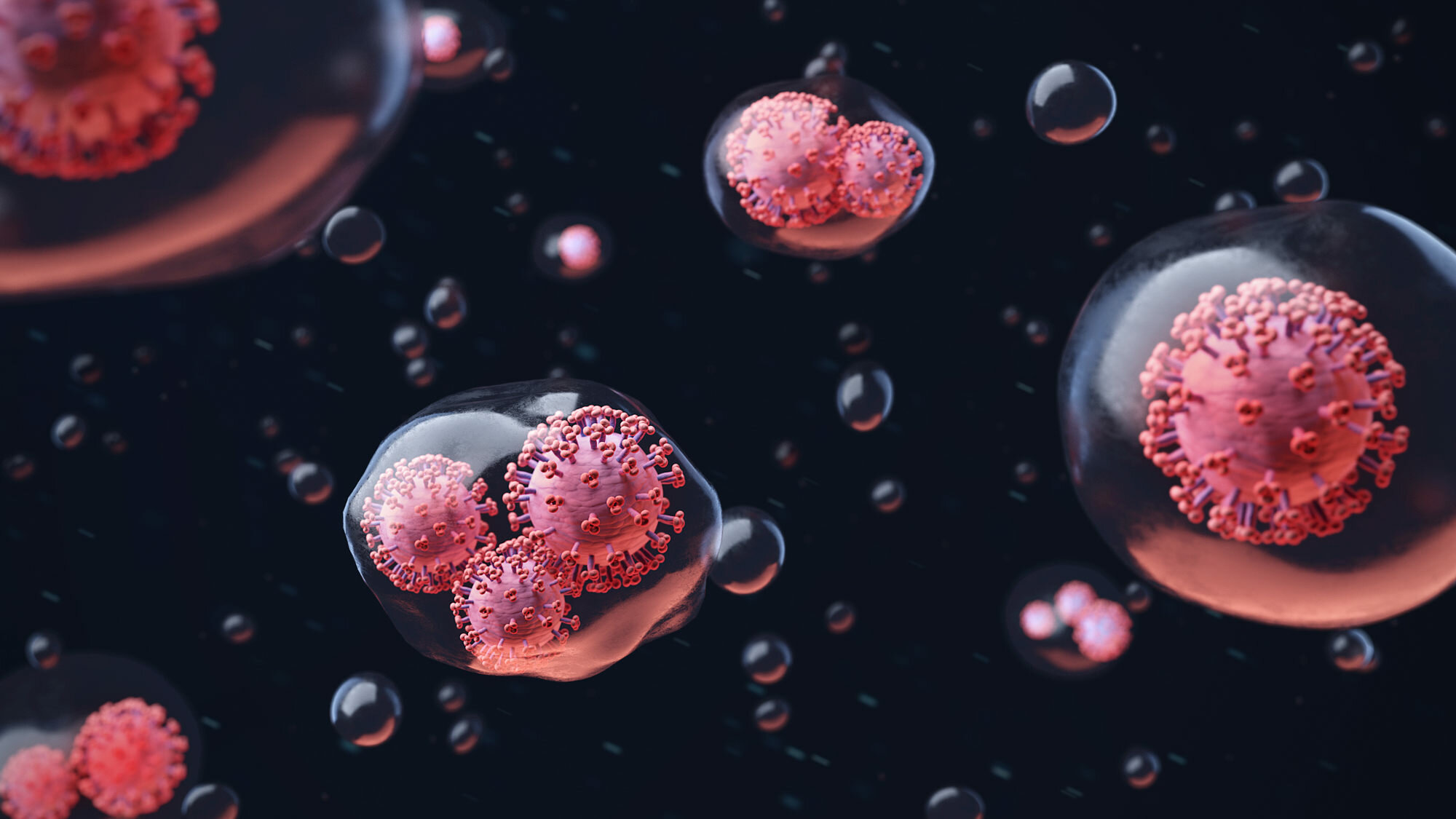 Minimising the spread of SARS-CoV-2 in dental clinics