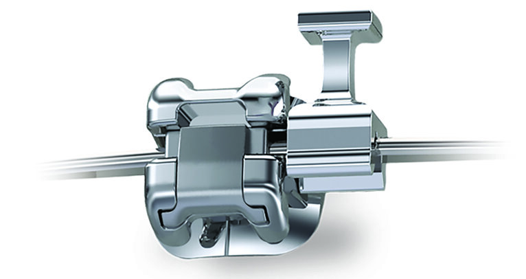 DT News - US - Ormco announces sole U.S. distribution of improved OrthoPulse Gen.2 device