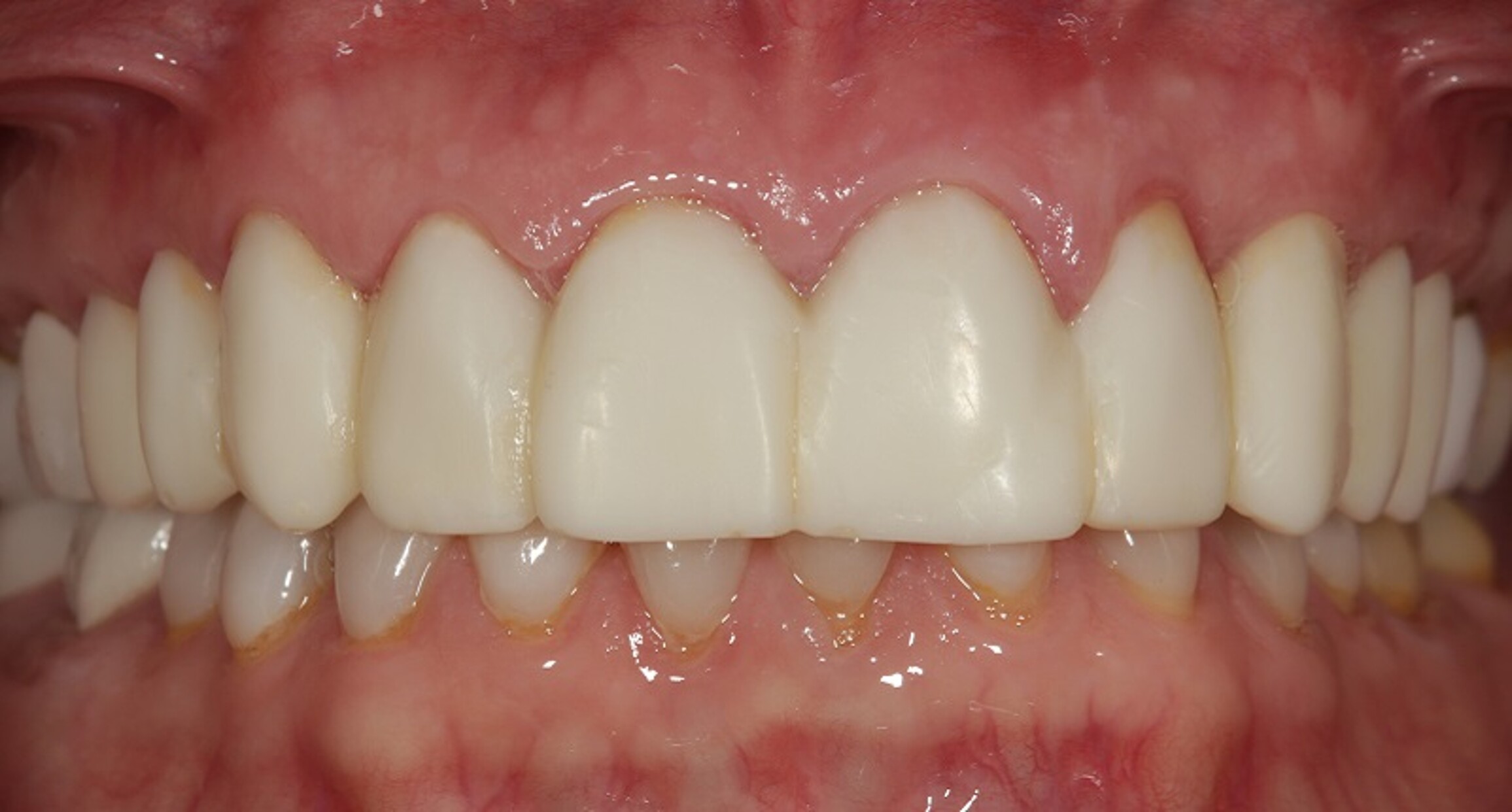 Dental News - Integrating digital smile design into the analogue ...