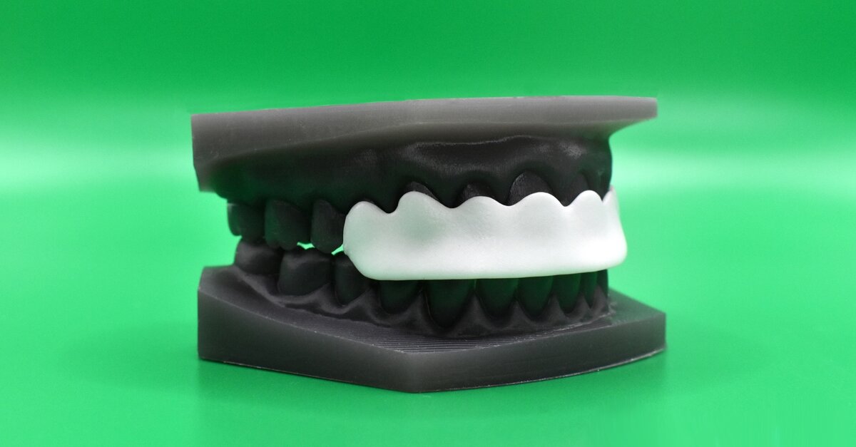 DT News - Spain - Nueva férula de reposicionamiento mandibular