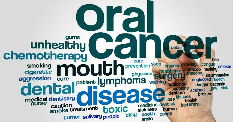 DT News - Italy - Oral Cancer Day: la prevenzione è sulla bocca di tutti