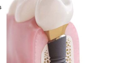 Solving clinical challenges with new treatment solution from DENTSPLY ...