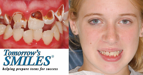 A smile makes a difference for a teen in need