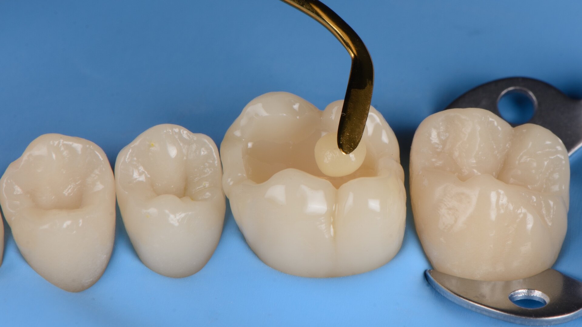 Dental News - Free webinar highlights advantages of biomimetic approach ...