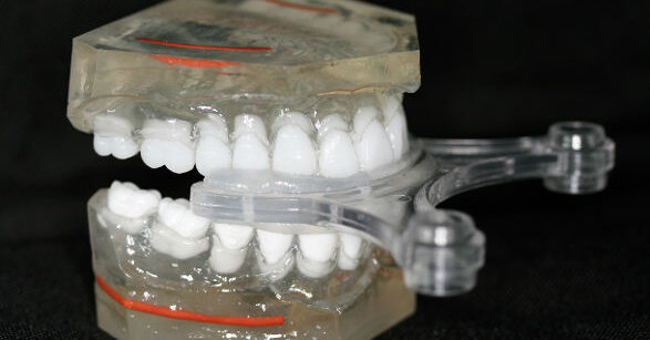 Use of an X-ray phantom in dental 3-D diagnostics in digital volume ...