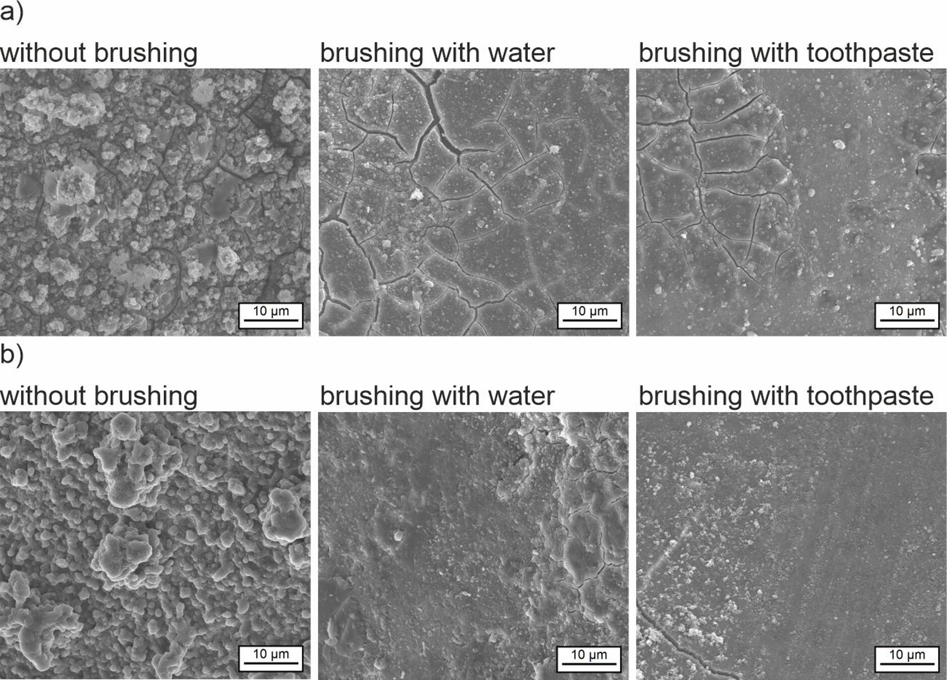 Milk inhibits tooth discoloration in chlorhexidine treatment