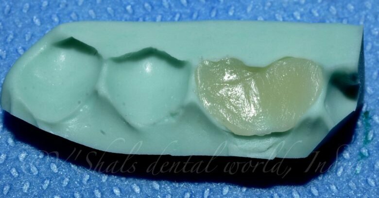 Custom shield Technique