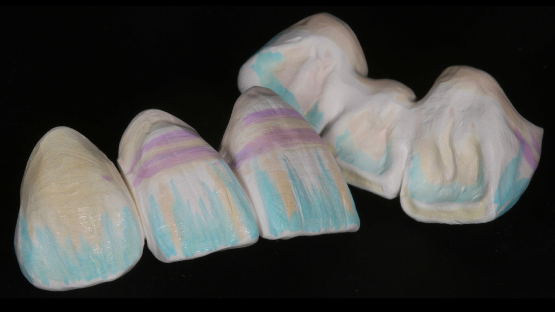 The zirconia dream team: Effect liquids and micro-layering