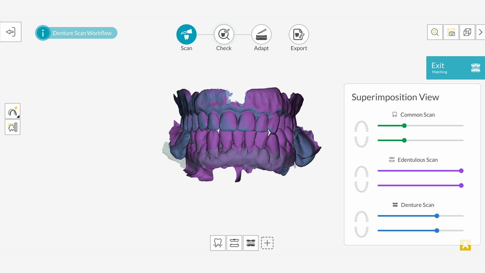 DEXIS intra-oral scanners with scan workflow for dentures