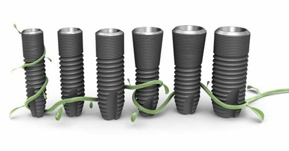 DT News - US - Astra Tech's latest implant system available in the US