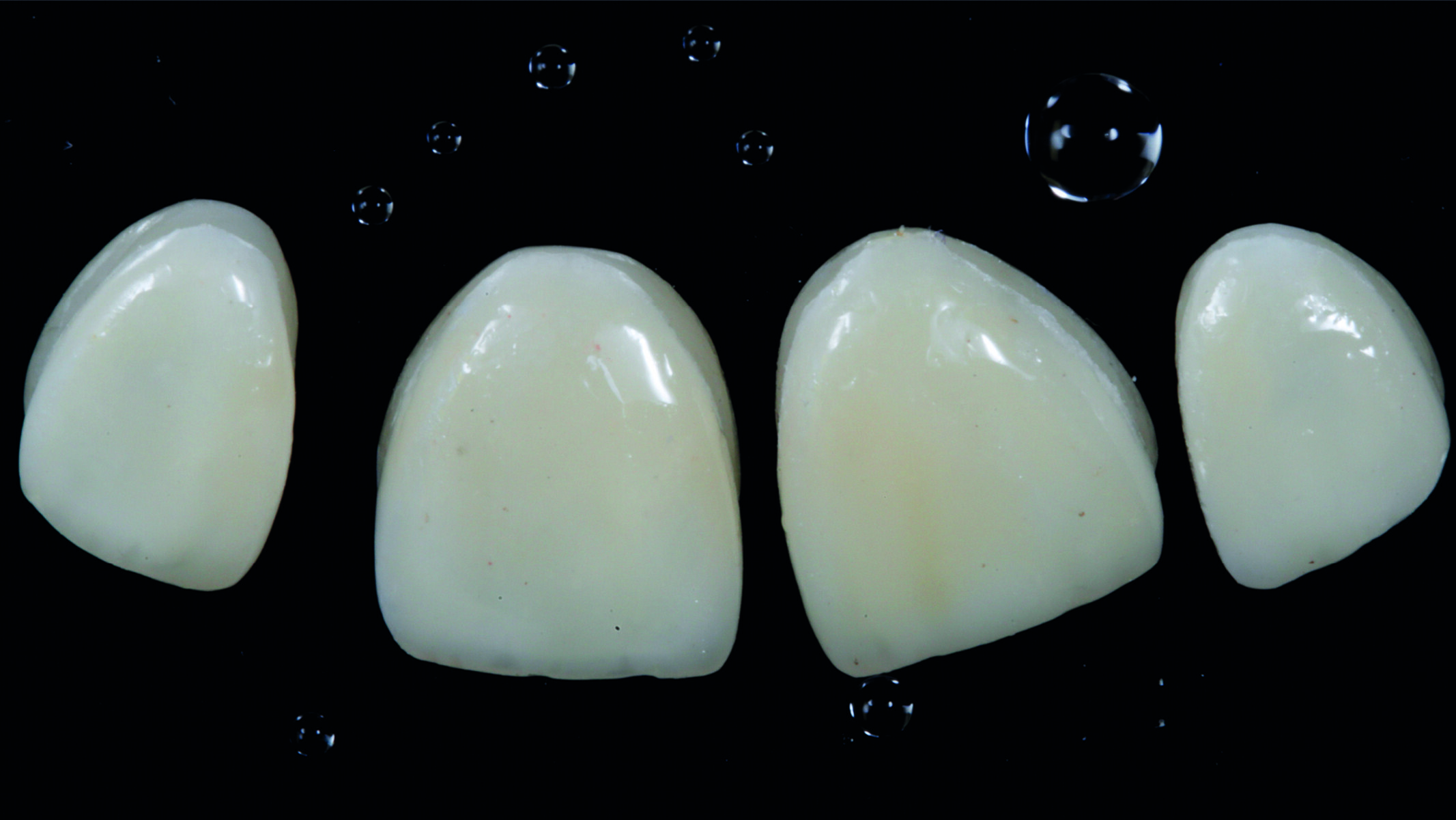 DT News - International - Extremely minimally invasive mock-up-guided ...