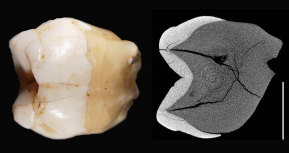 Research on fossilised teeth redefines human and Neanderthal history