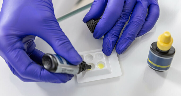 Dental News - EssenSeal: A new-generation root canal sealer