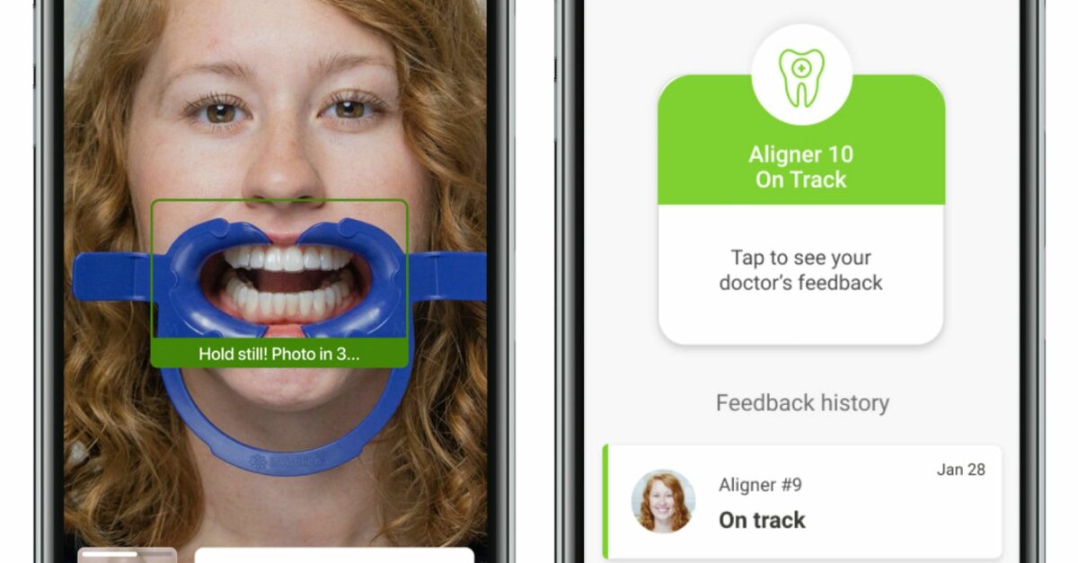 Align Technology launches Invisalign Virtual Care AI 3.0