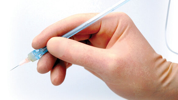 Dental News - The STA-intraligamentary injection vs. the PDL