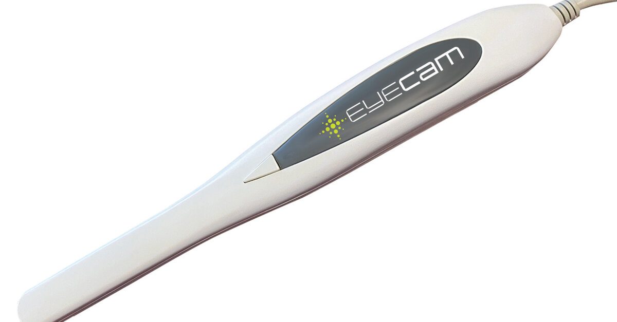 New EyeCam gets clean images with the press of a single button