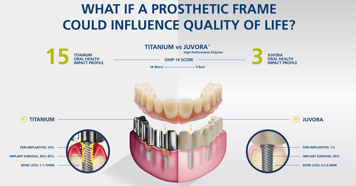 Dental News - Using PEEK frameworks for full arch implant supported ...