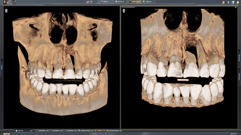 Dental News - Sidexis 4: More than just imaging software
