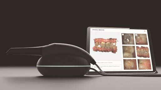 DT News - International - 3DISC reinvents the intra-oral scanner with OVO
