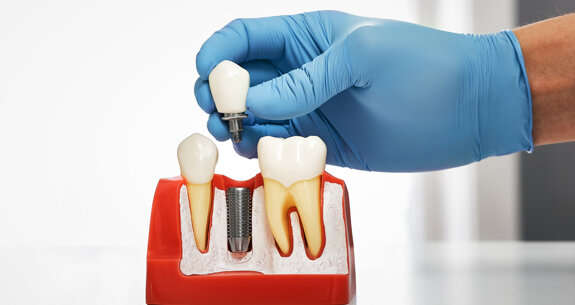 DT News - International - Chinese patients to save 50% on dental ...