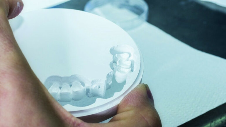 Dental News - Restoring function and aesthetics with monolithic ...