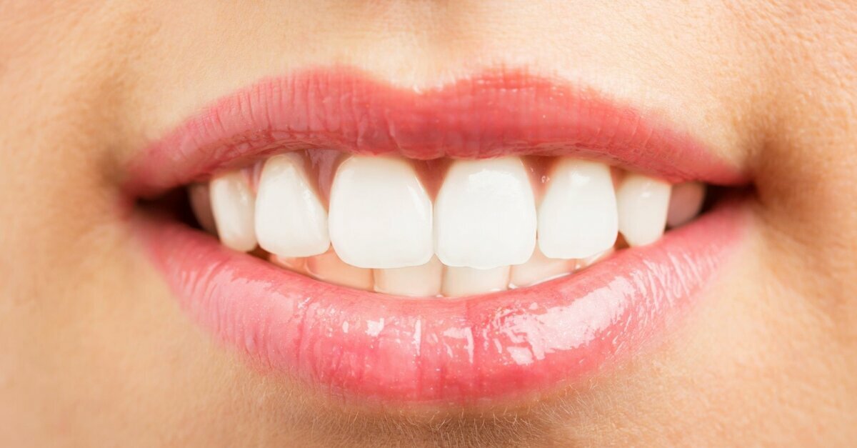 DT News - Netherlands - FDI lanceert Proud Mouth Challenge