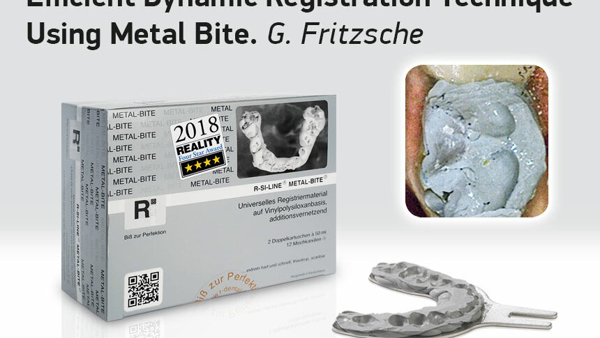 Efficient Dynamic Registration Technique Using Metal Bite.
