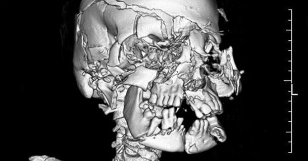 Dental News - Forensic odontology—Broader than just identification