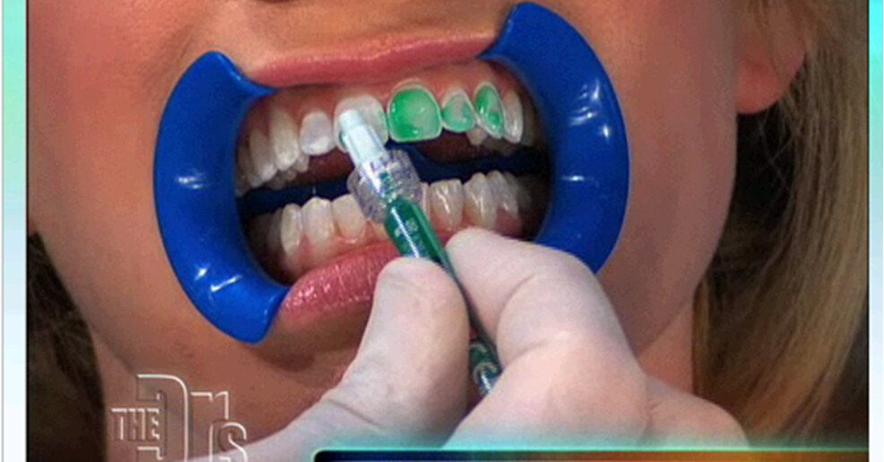 Dental News - New dental treatment is featured on TV program