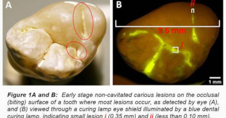 Dental News - GreenMark to develop technology for early caries detection