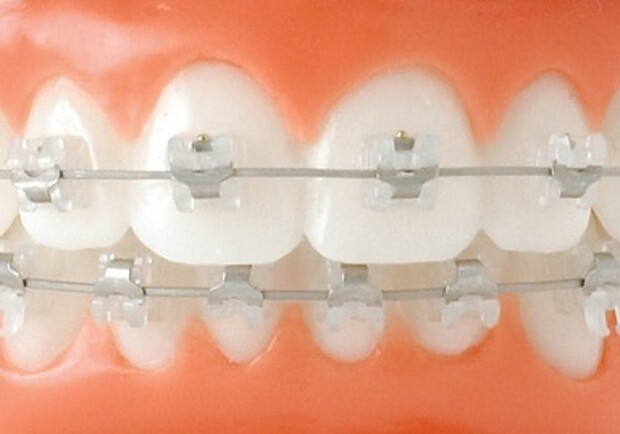 Dentsply – GAC BioForce High Aesthetic Archwire