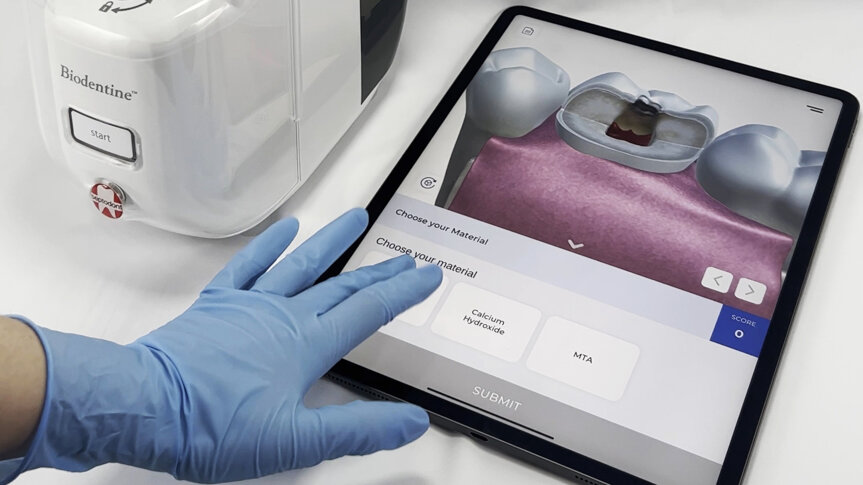 New FDA-approved device will help detect Barrett’s esophagus