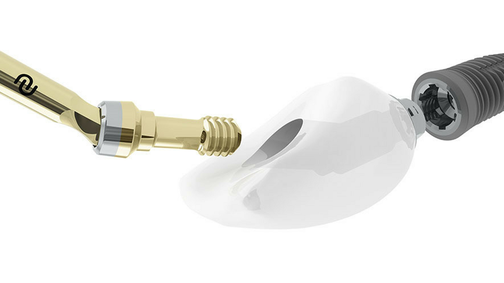 Angulated Screw Access Solution