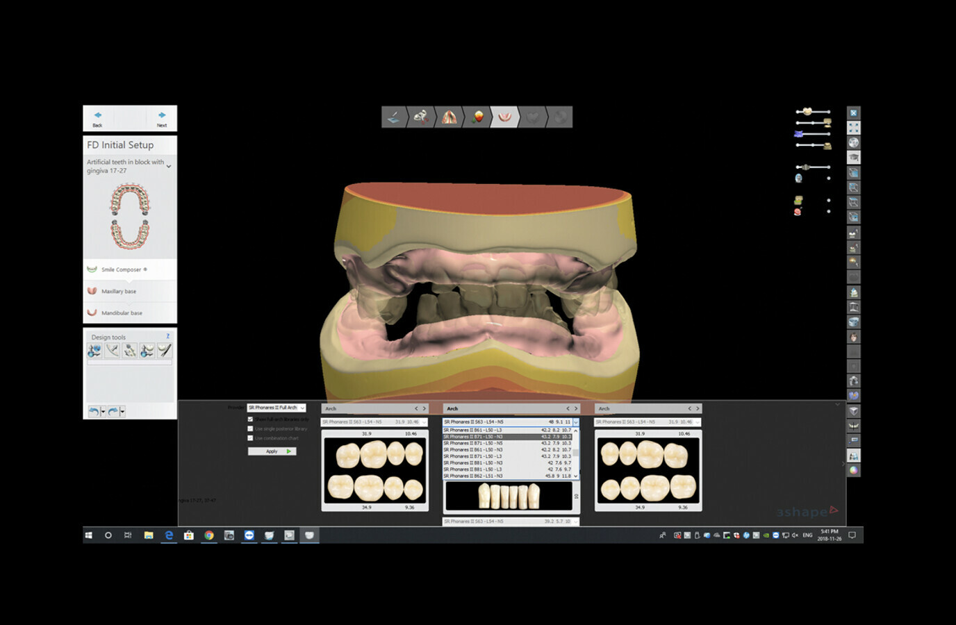 Ivoclar – Digital Denture CAD software