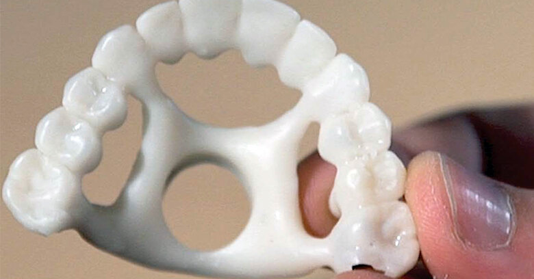 Hybrid Technologies grows business with full-arch palatal Jigs 3D ...