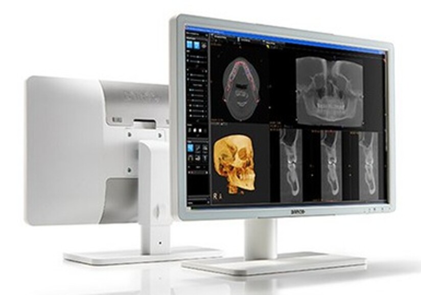 Barco Eonis dental displays