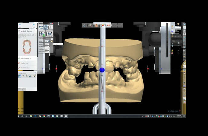 Ivoclar – Digital Denture CAD software
