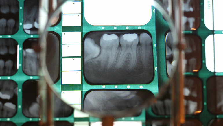 Dental News - Artificial intelligence shows promise for detecting ...