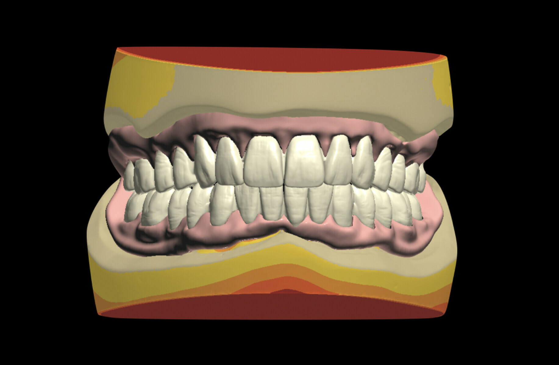 Ivoclar – Digital Denture CAD software