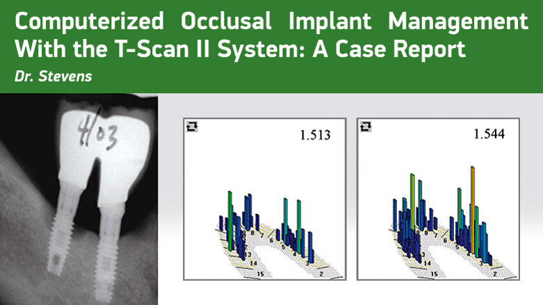 DT News - Greece - Computerized Occlusal Implant Management With the T ...