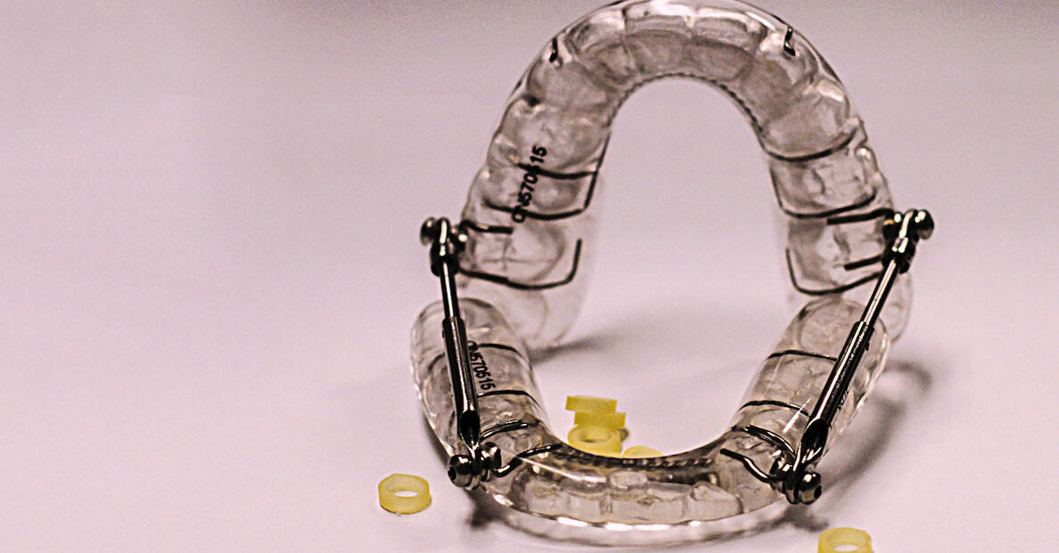 DT News - Latin America - Aparatología de avance mandibular para Apnea ...