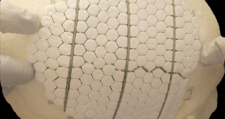 Bioceramic sealer One-Fil by MEDICLUS tested in study