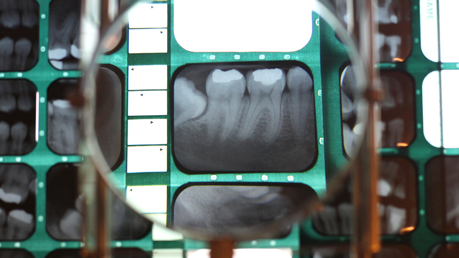 Dental News - Artificial intelligence shows promise for detecting ...