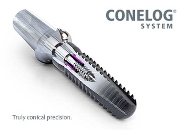 CONELOG IMPLANT SYSTEM