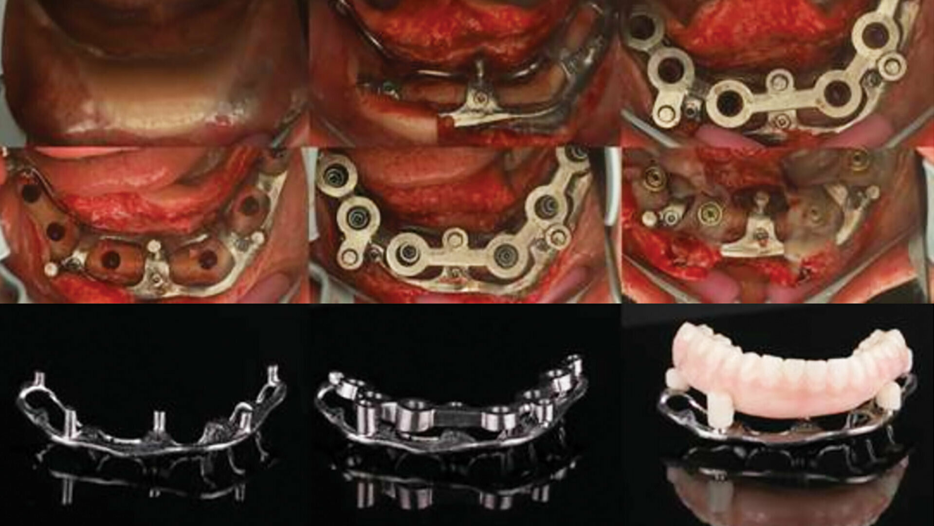 Dental News - Drs. Cory Glenn and Danny Domingue now offering in-person ...