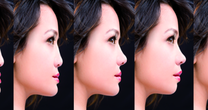 Smile Design Wheel: A simplified protocol for smile design