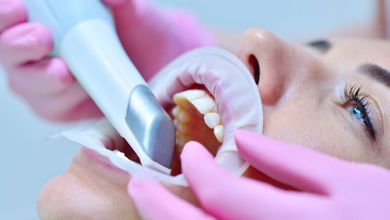 Dental News - Study finds intra-oral scanner viable alternative to ...