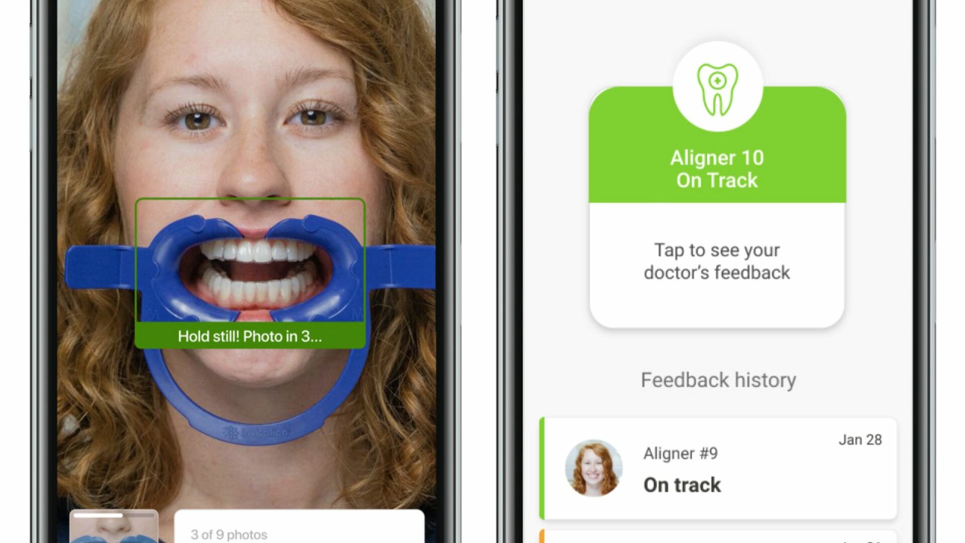 Align Technology launches Invisalign Virtual Care AI 3.0